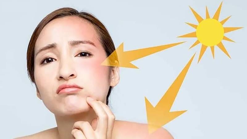 Da mặt bị cháy nắng làm sao để trắng lại?