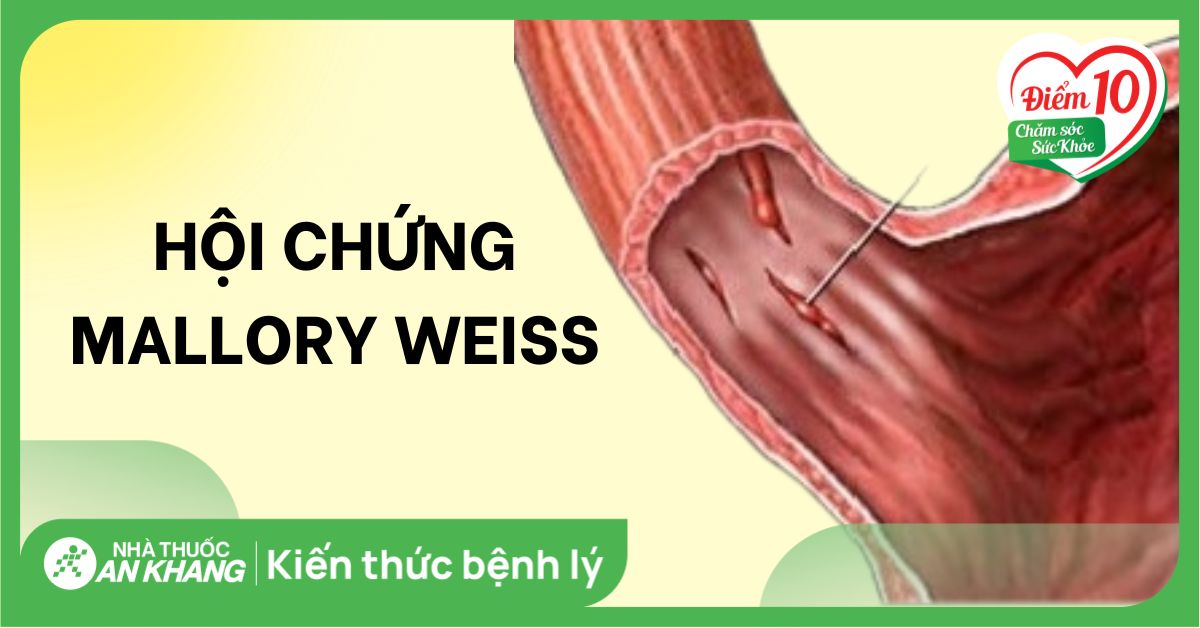 Hội chứng Mallory Weiss: Dấu hiệu nhận biết và cách điều trị