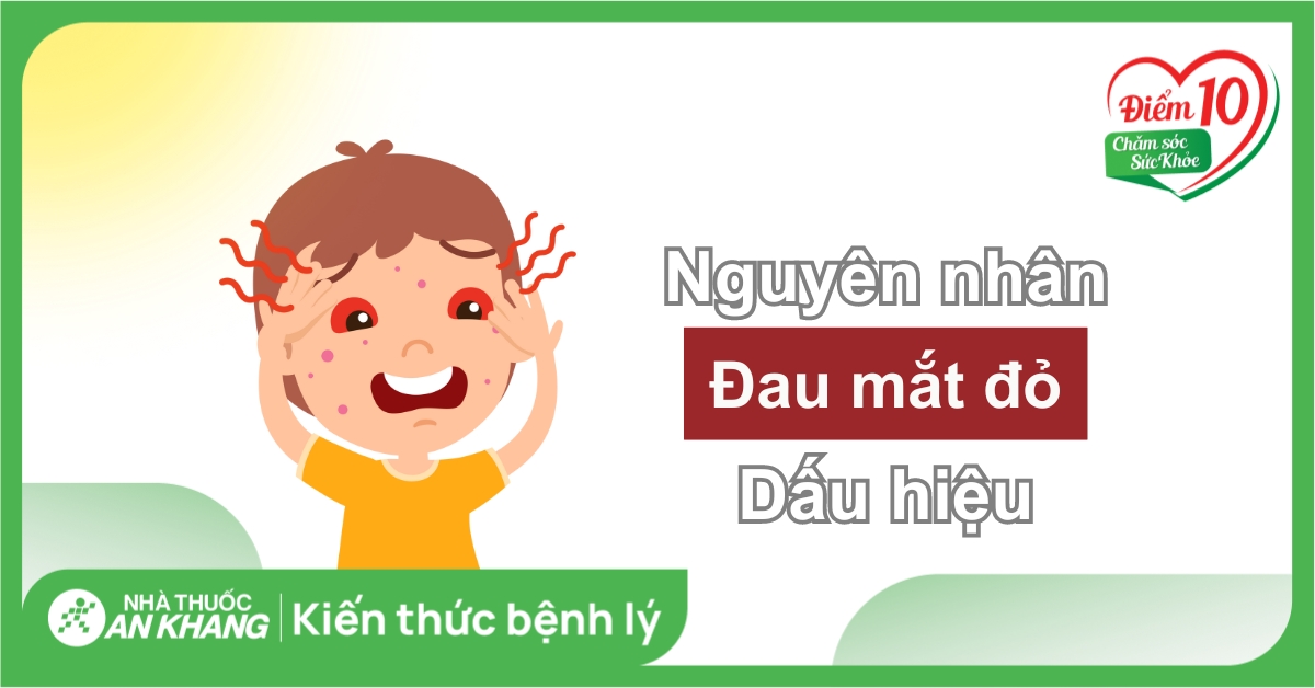 Bệnh đau mắt đỏ: Nguyên nhân, Dấu hiệu nhận biết và Cách điều trị