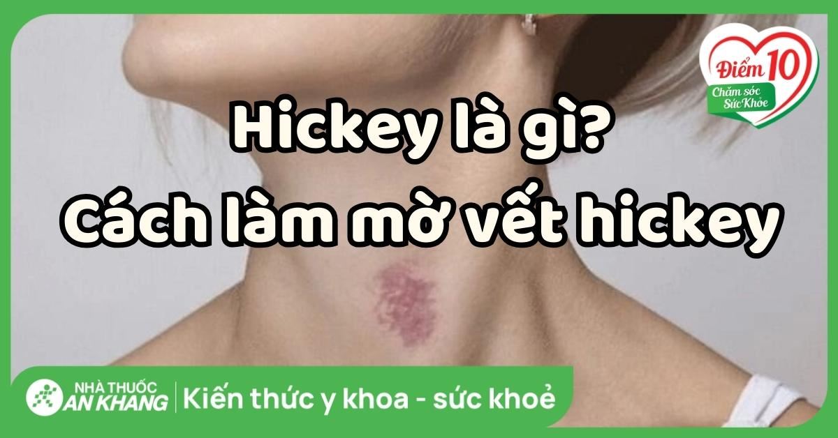 Hickey là gì? Cách làm mờ vết hickey nhanh chóng tại nhà